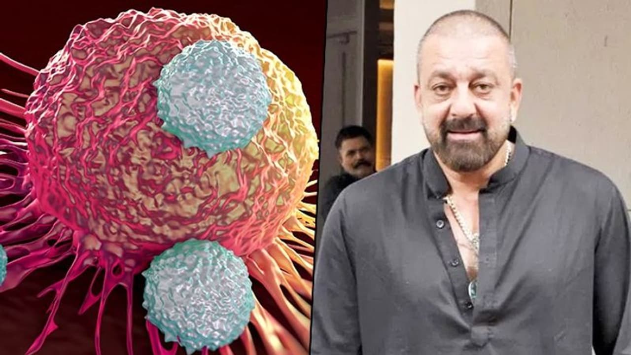 Sanjay Dutt diagnosed with cancer: 2 types of cancer that are difficult ...