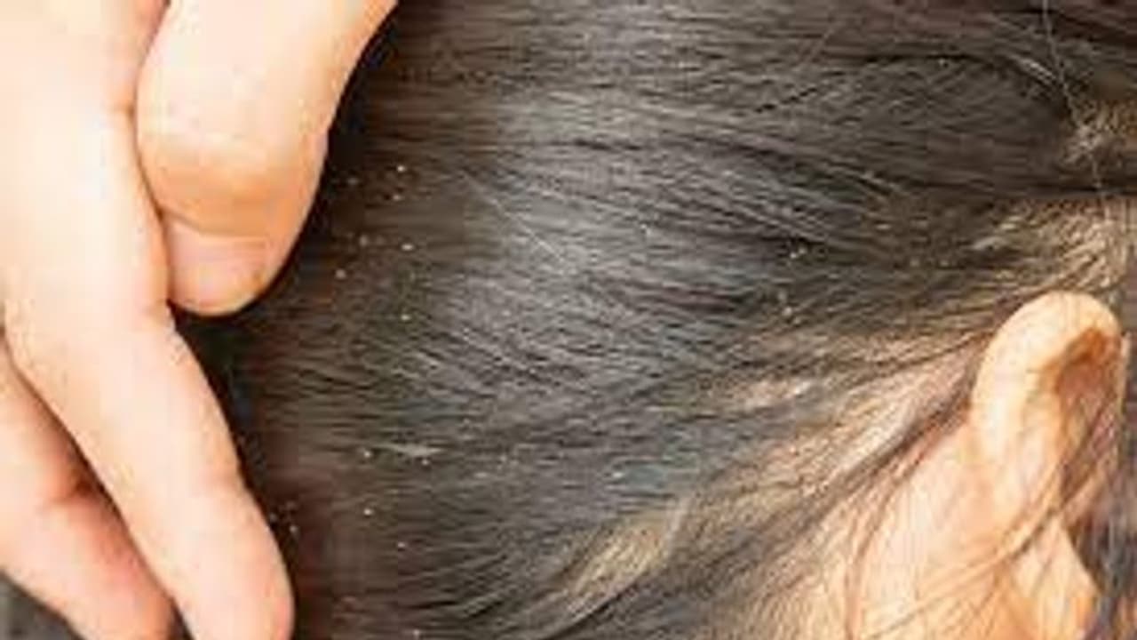 Flight emergency landed after passenger spot lice crawling woman hair ...