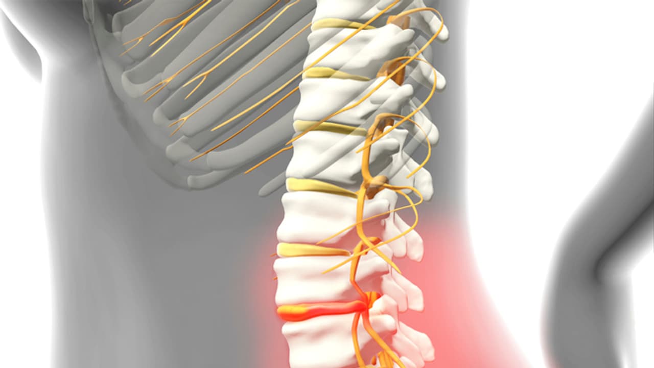 Cause of Slipped Disc স্লিপ ডিস্কের শিকার হতে না চাইলে মেনে চলুন এগুলি ...