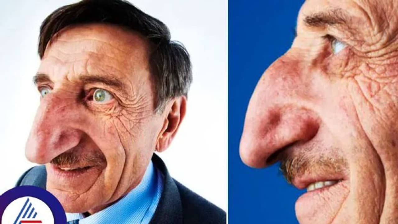 ವಿಶ್ವದಲ್ಲೇ ಅತೀ ಉದ್ದದ ಮೂಗು, ಗಿನ್ನಿಸ್ ವರ್ಲ್‌ ರೆಕಾರ್ಡ್ ಮಾಡಿದ್ದ ವ್ಯಕ್ತಿ ...