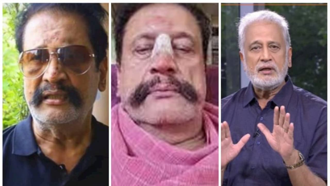 mohan sharma attacked : അടിച്ച് മുഖം പൊളിച്ചു, ആസിഡ് ആക്രമണത്തിന് ...