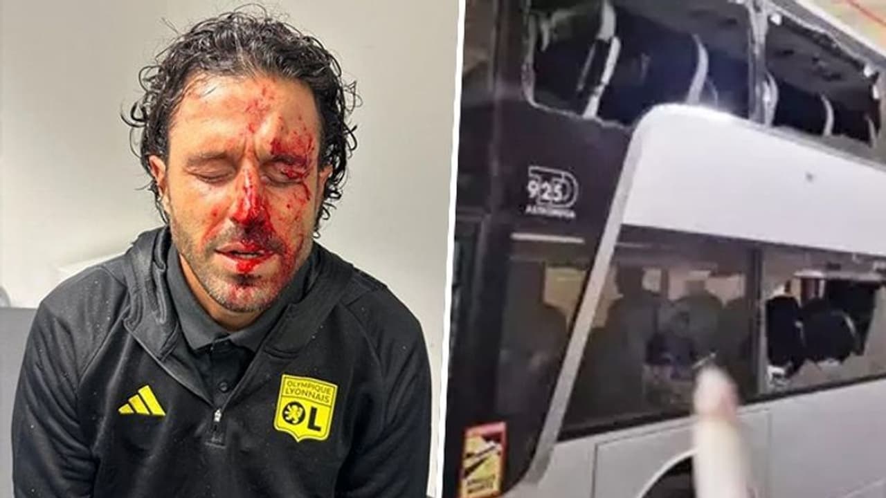 Drama in Ligue 1 after Lyon manager injured in violent team bus attack ...