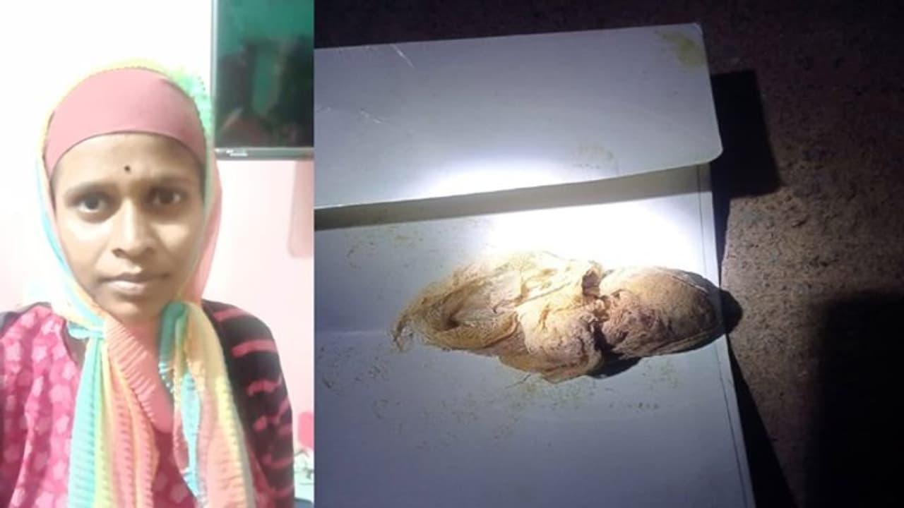 Doctor negligence Left 3 feet long cloth inside women stomach after ...