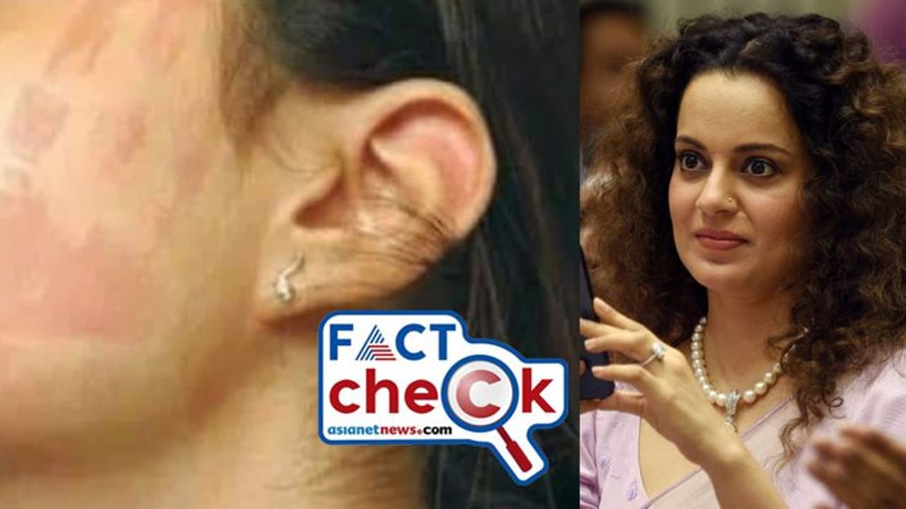 Photo of the slap mark on Kangana Ranaut’s face, Fact Check | സിഐഎസ്എഫ് ...