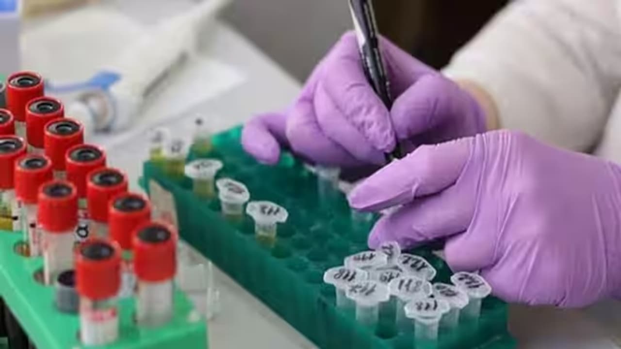 Over 300 deadly virus samples go missing from Australian lab in ‘major ...
