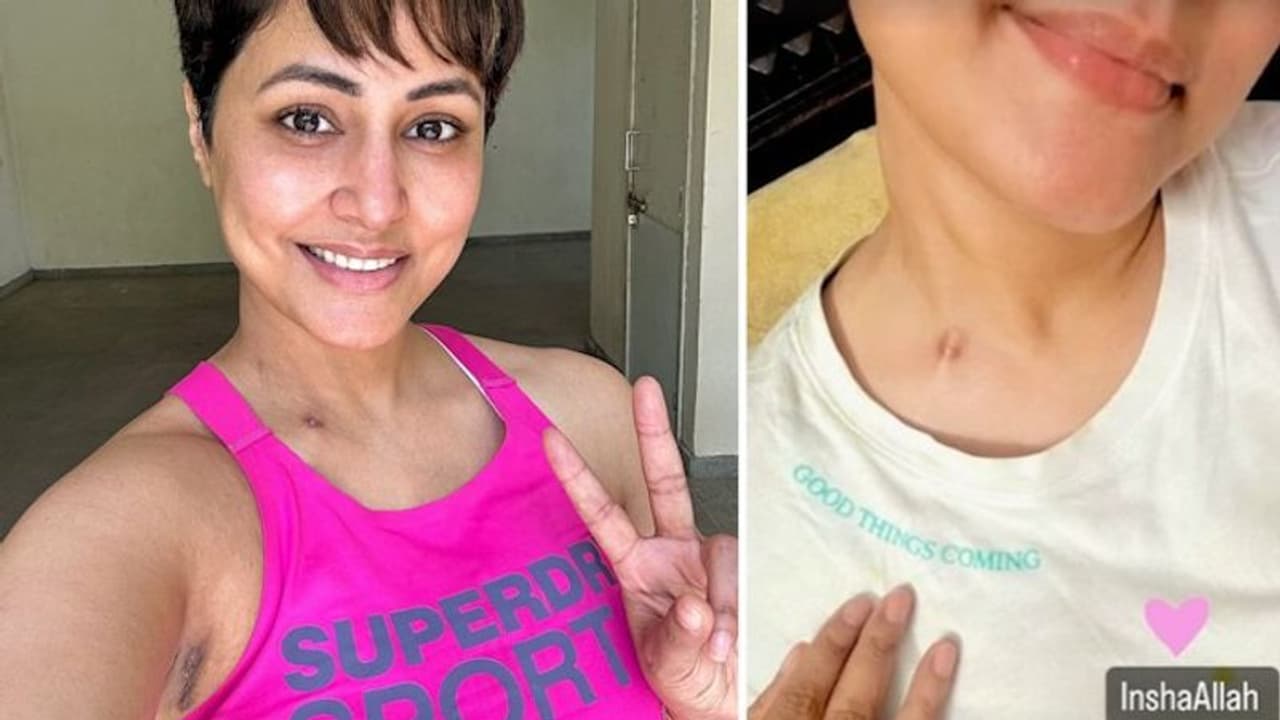 Hina Khan shows off chemotherapy scar following stage 3 breast cancer ...