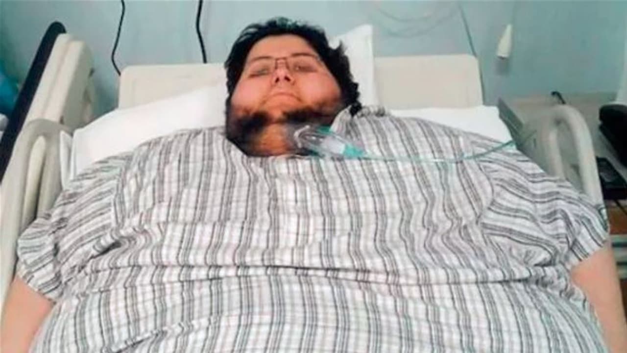Worlds fattest man ಎನಿಸಿಕೊಂಡಿದ್ದ Saudi Man ಈಗ ಹೇಗಿದ್ದಾನೆ ನೋಡಿ: 6 ...