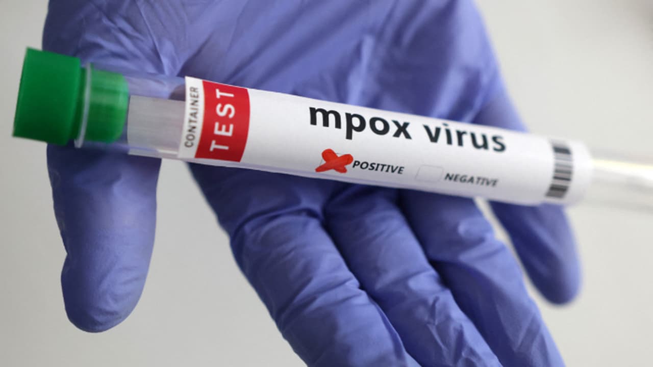 Pakistan's second Monkeypox case in 2025 confirmed in Karachi; 28-year ...