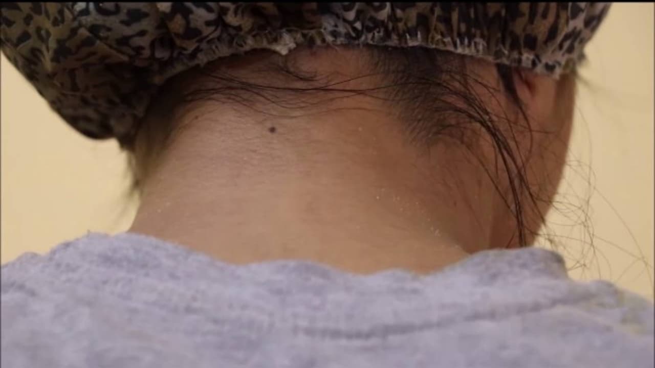 How to lighten a dark neck at home? 6 simple remedies you can try ...