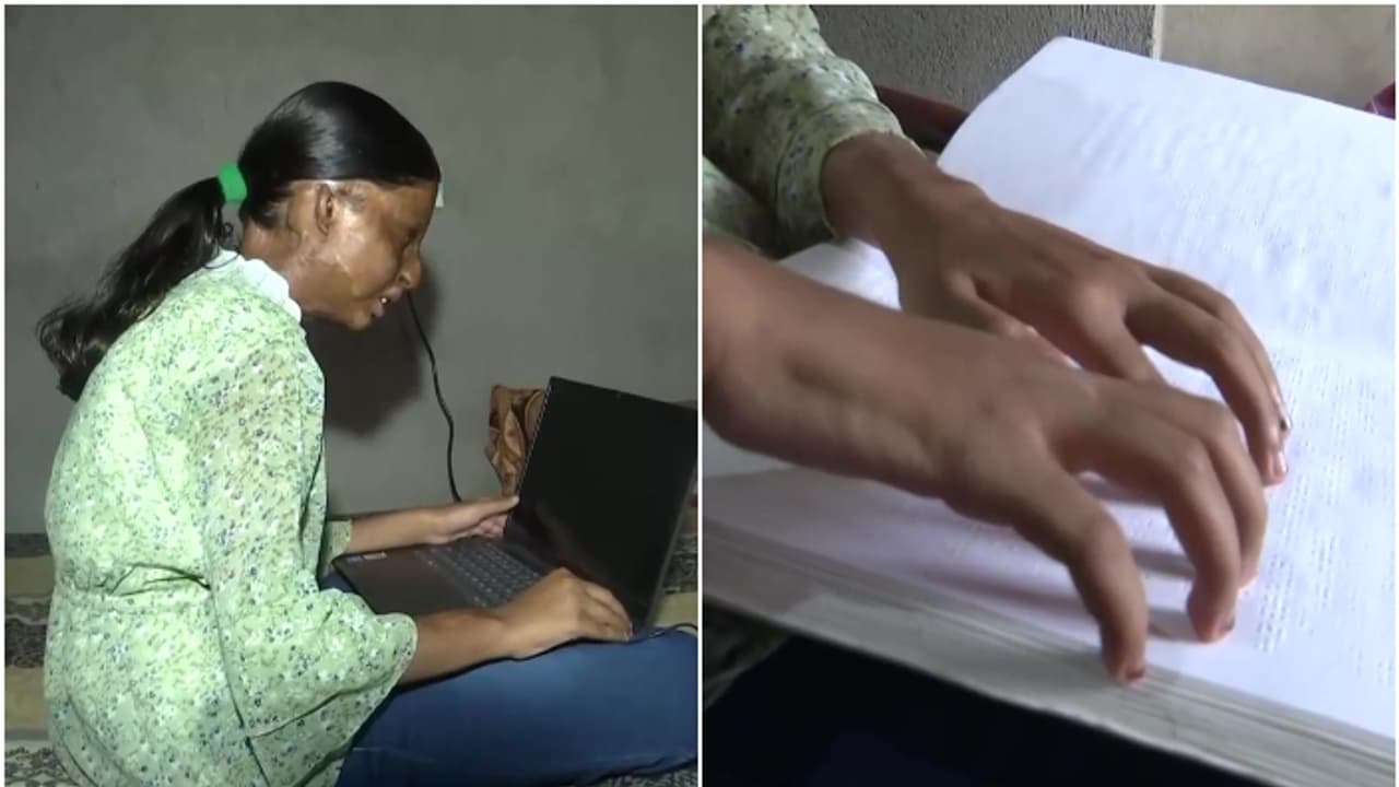 Acid attack survivor lost eyesight topper CBSE 12th standard Kafi's ...