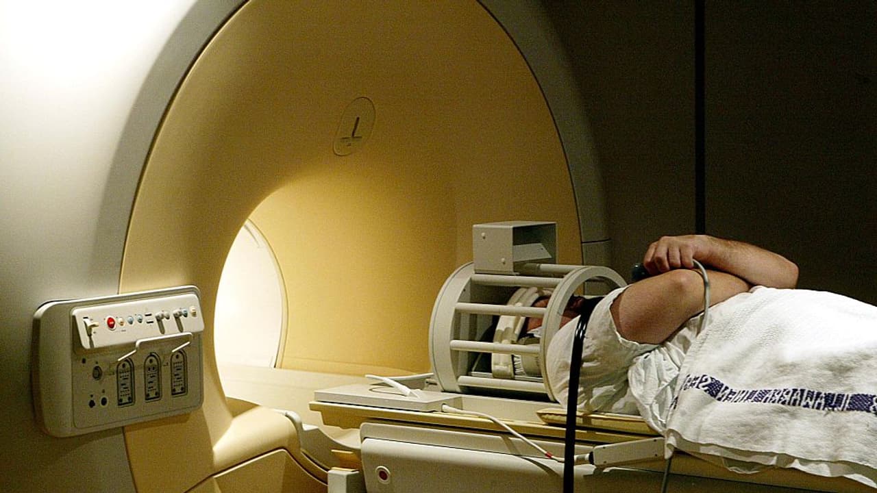 BREAKTHROUGH! MRI scan that spots rapid aging, signals dementia long ...