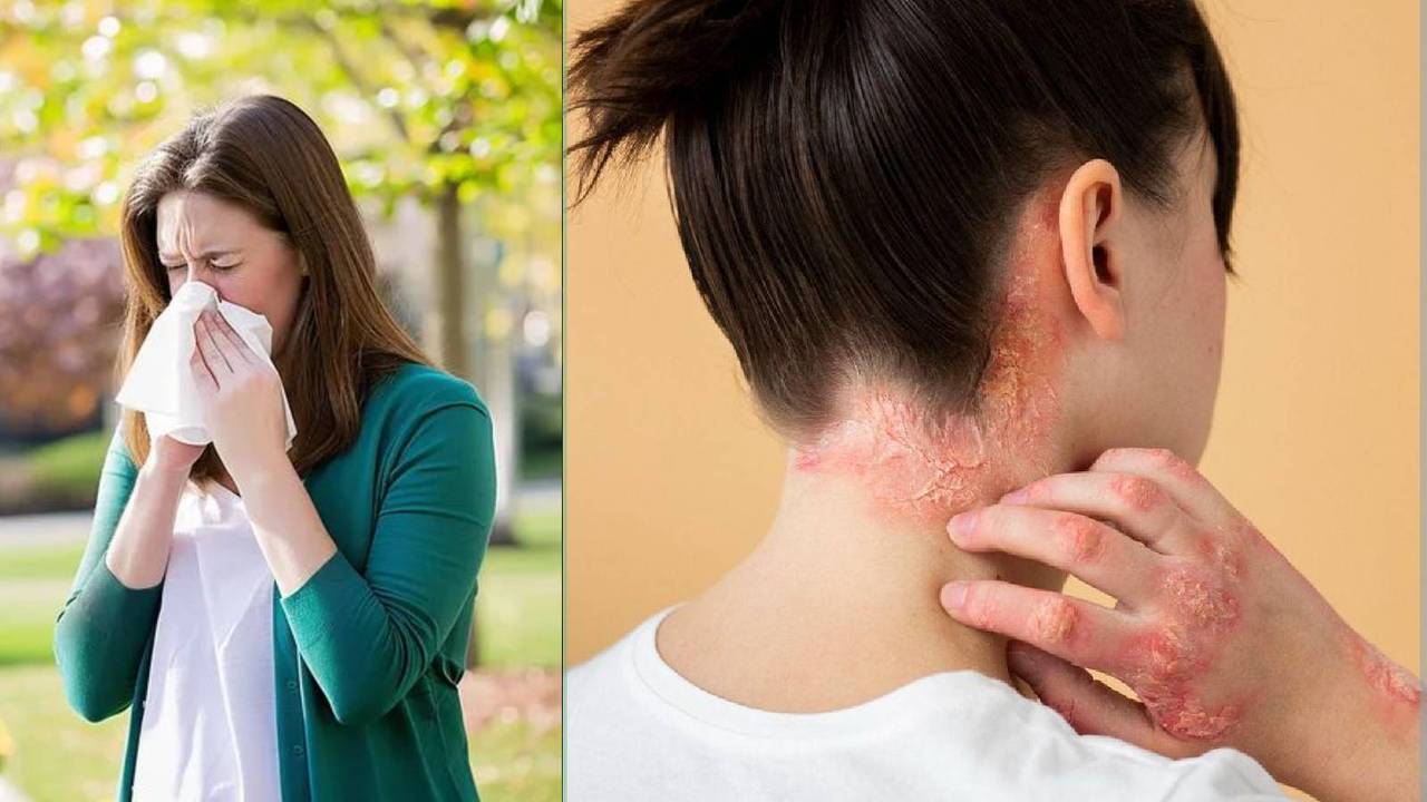 World Allergy day 2025: অ্যালার্জি থেকে হতে পারে জীবন সংশয়? সামনে এল ...