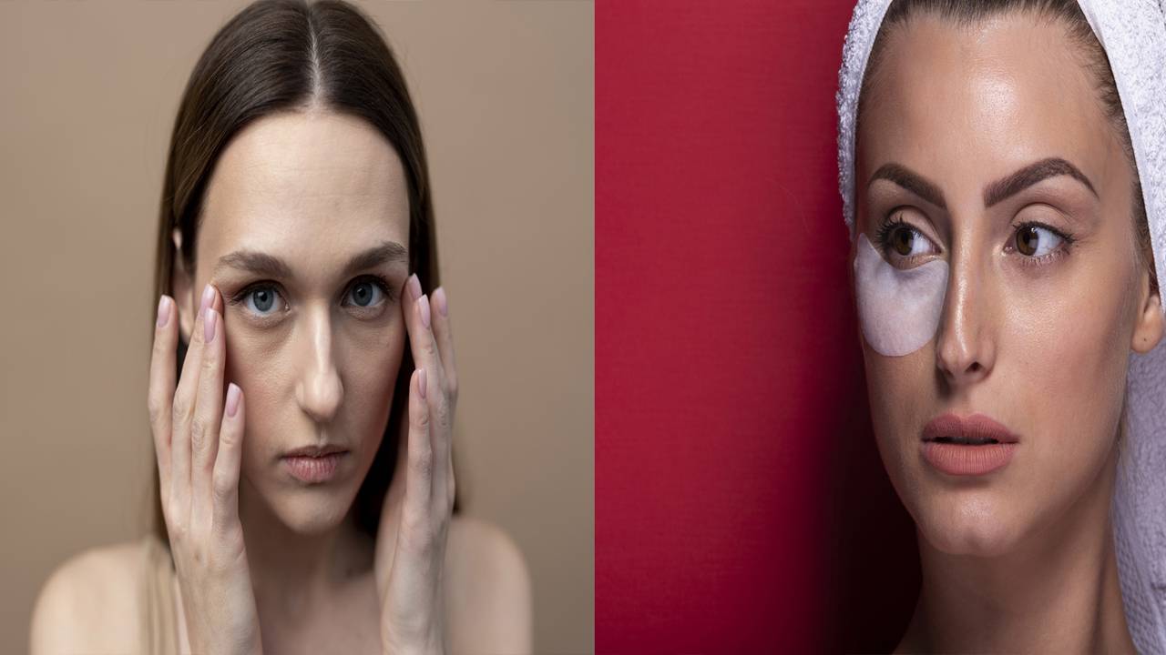 Say Goodbye to Dark Circles: Natural Home Remedies for Bright ...