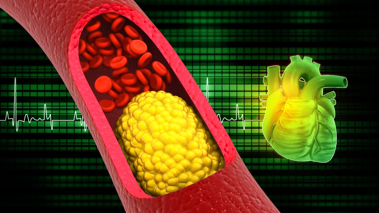 New Cholesterol Drug Cuts Bad Cholesterol by Nearly 60% in First-Year ...