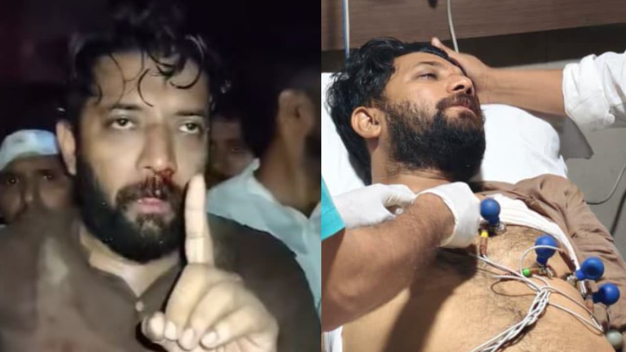 Shafi Parambil | ഷാഫി പറമ്പിൽ എംപിക്ക് മർദനം; മൂന്ന് ഉദ്യോഗസ്ഥർക്കെതിരെ ...