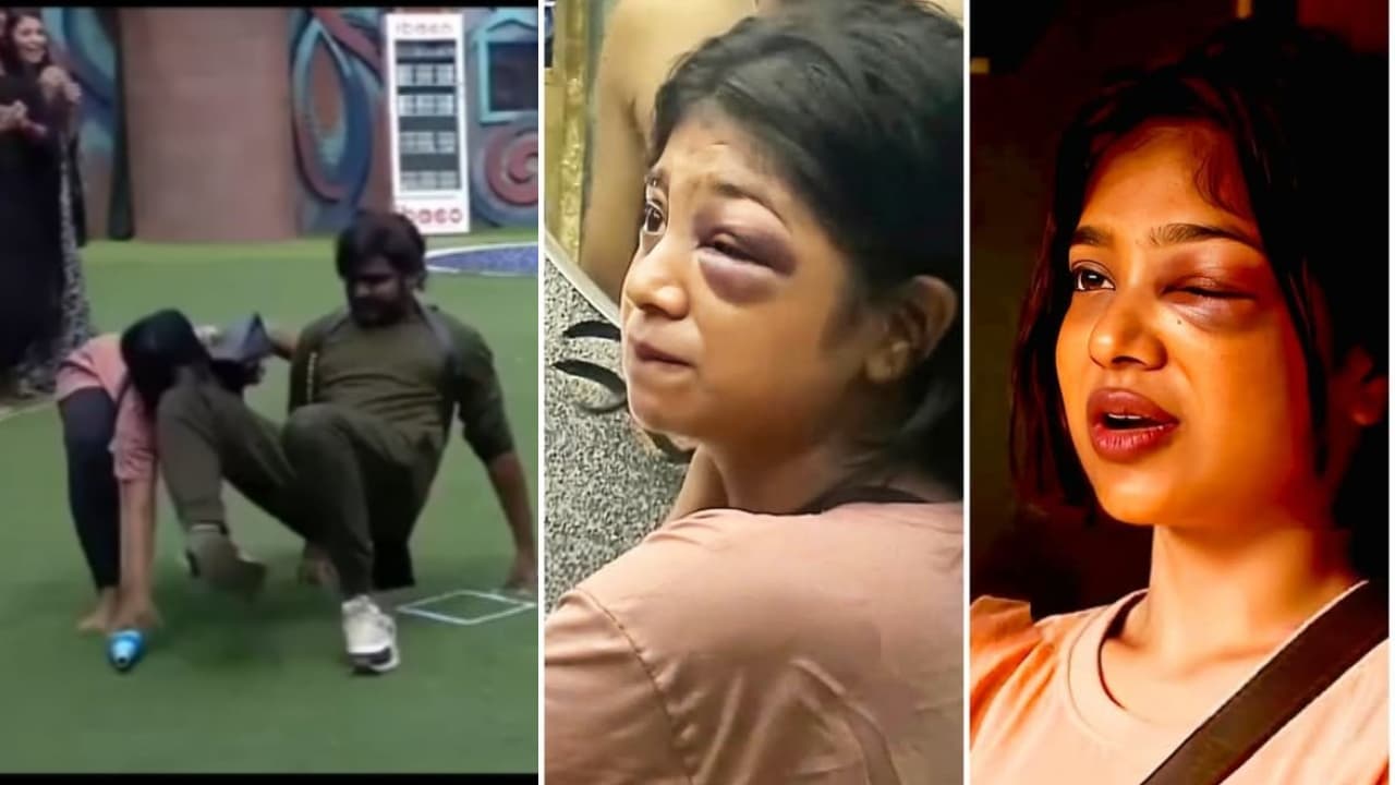 'ഇതാണ് മത്സരാർത്ഥി'; ടാസ്കിനിടെ ഗുരുതര പരുക്ക്, ഒരു കണ്ണ് പകുതി അടഞ്ഞ് ...