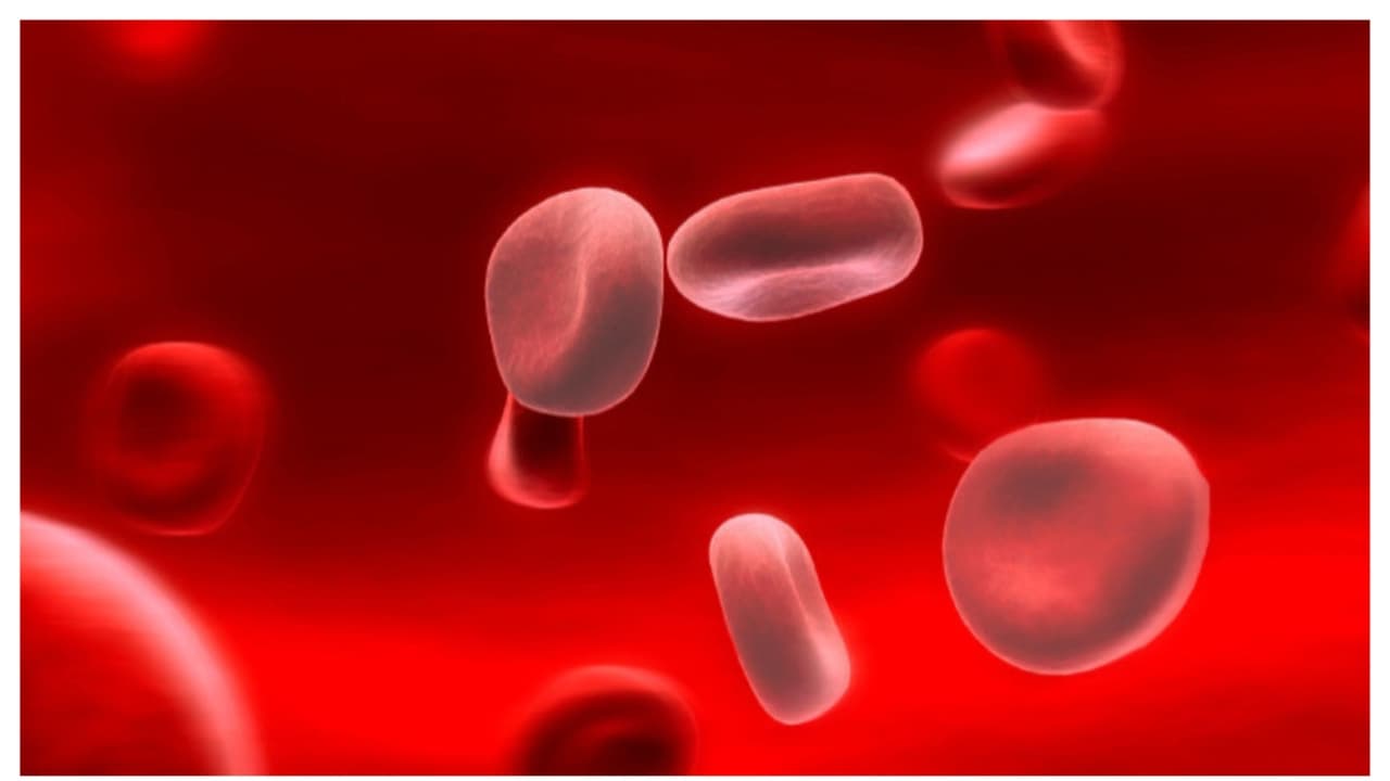 Early Signs of Anemia: How to Detect Iron Deficiency Before It Gets ...