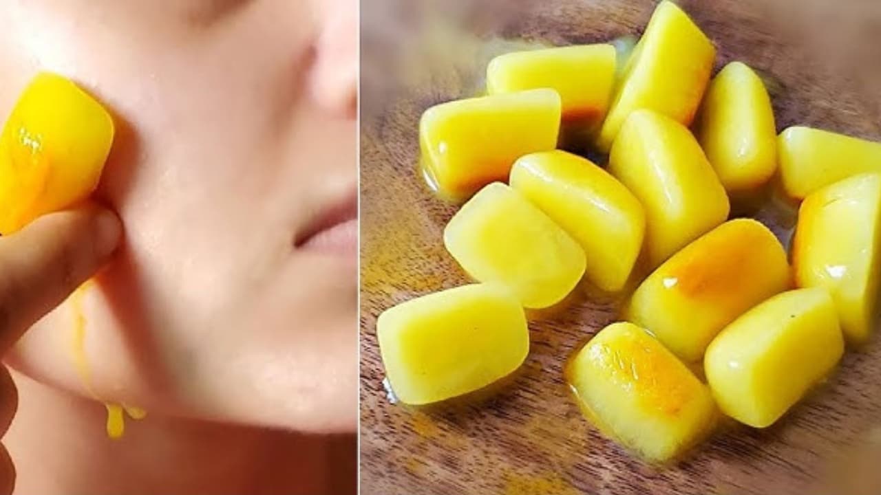 Turmeric Ice Cubes: పసుపు, ఐస్ క్యూబ్స్‌తో ఇలా చేస్తే చర్మం ...