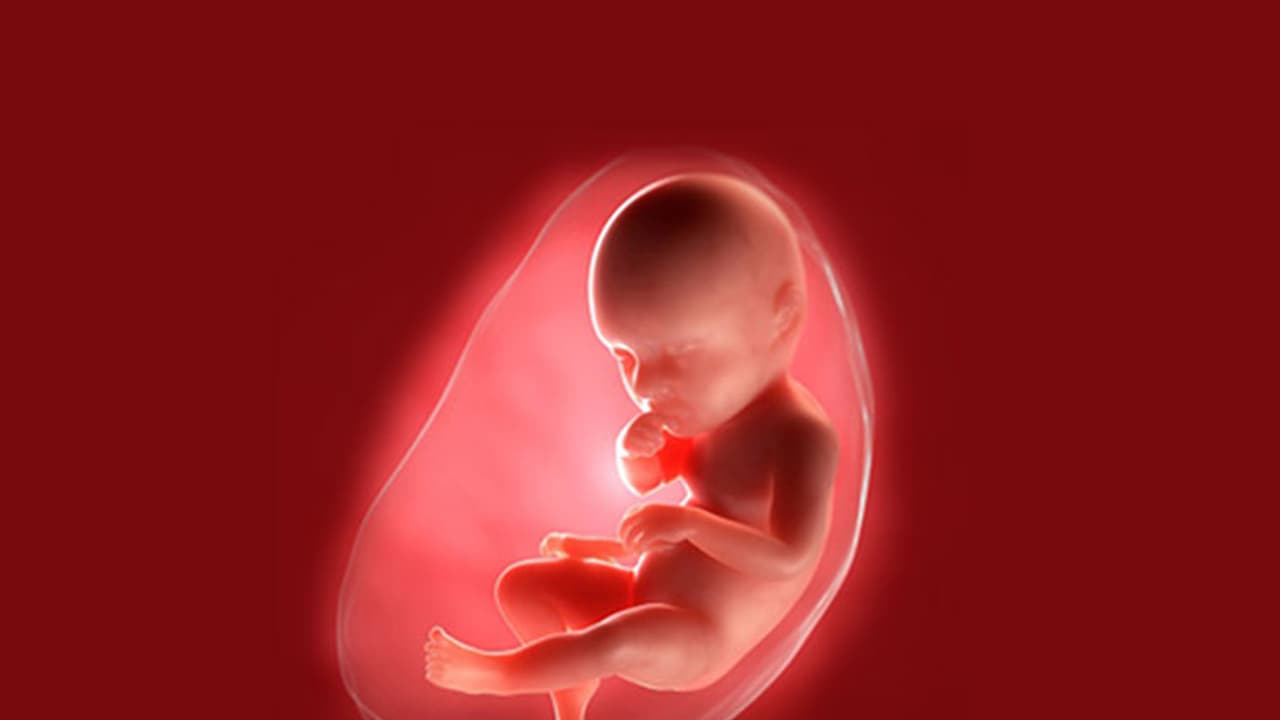 Stone baby rare case doctor remove 24 week calcified remains ಮಹಿಳೆಗೆ ...