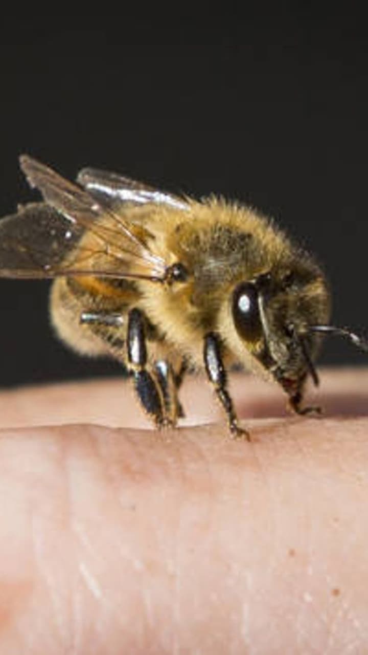 சீனாவில் தேனின் விஷம் மூலம் சிகிச்சையா? | Benefits Of Bee Sting Therapy ...